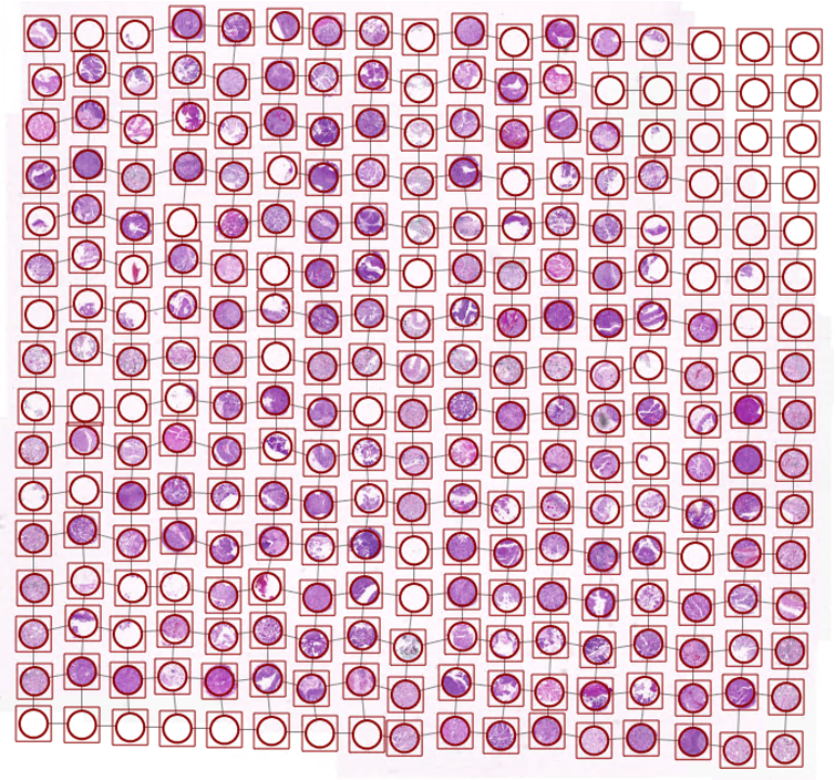 Image Analysis | Queen's Laboratory for Molecular Pathology